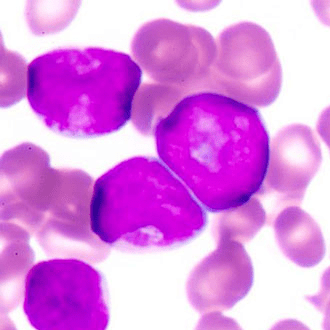 The Jackson Laboratory makes new AML mouse models available to researchers