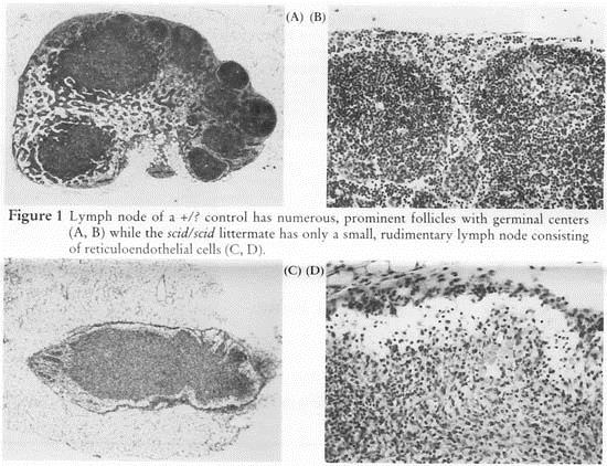 The severe combined immunodeficiency scid mutation
