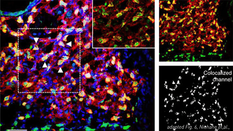Mouse lung progenitor cells differentiate along all epithelial lineages ...